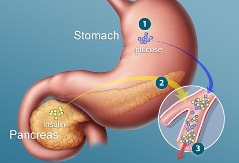 webmd_illustration_of_stomach_and_pancreas - Genesis Gym